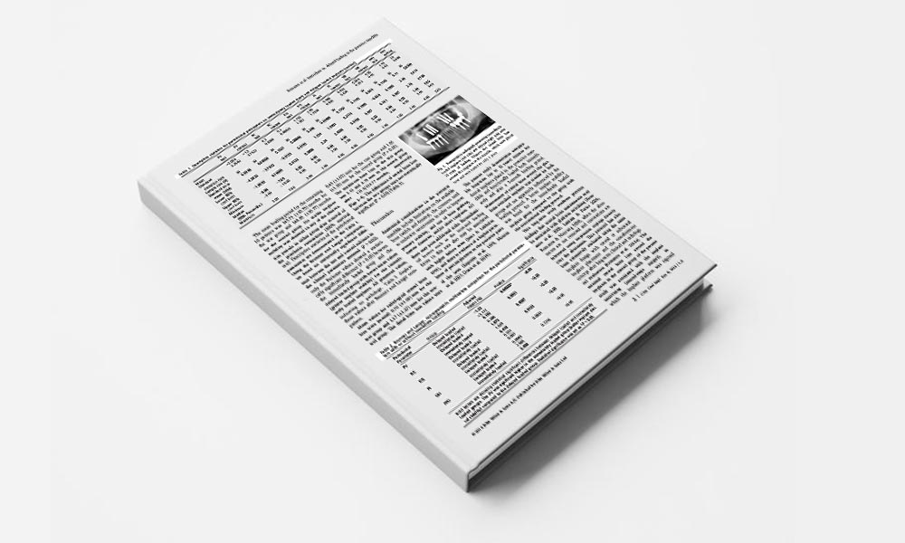 Immediate vs delayed loading in the posterior mandible: a split-mouth ...